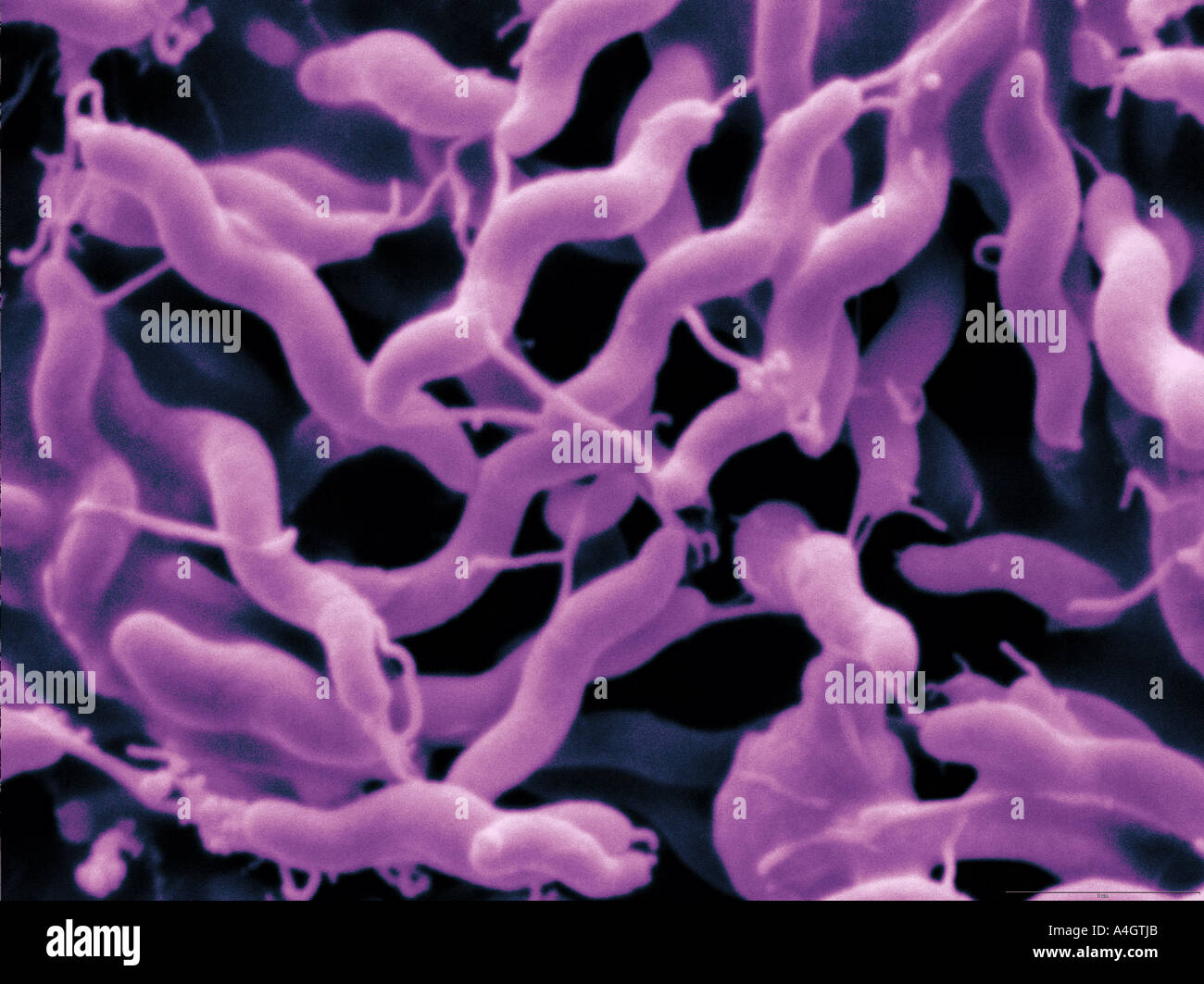 Scanning electron microscopy bacteria hi-res stock photography and ...