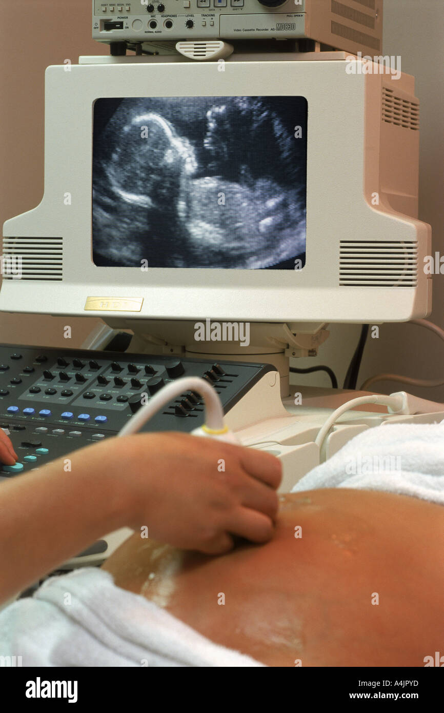 Doctor using probe during ultrasound test with five month old fetus on ...