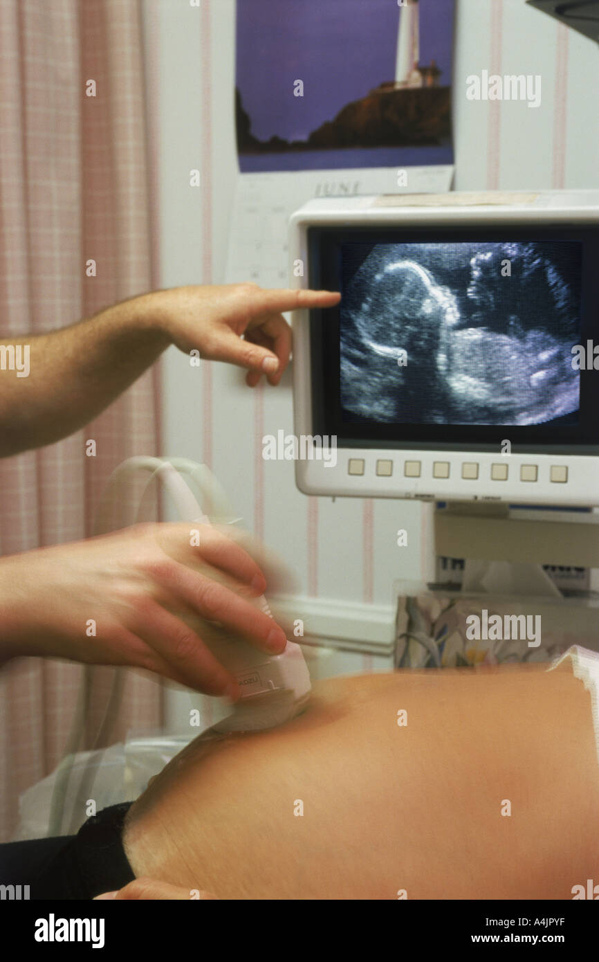 Male doctor using probe during ultrasound test with five month old ...