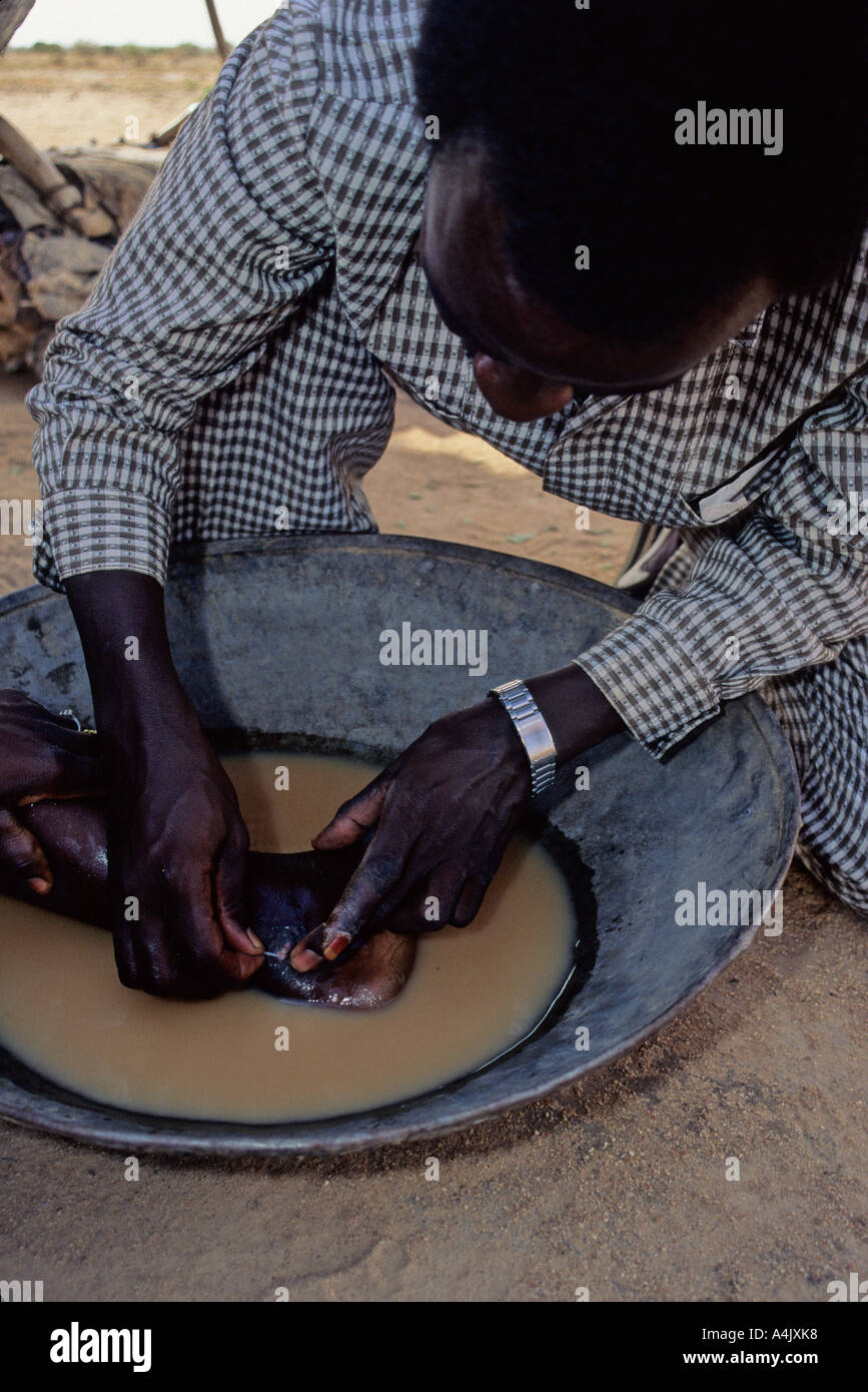 Guinea worm parasite hi-res stock photography and images - Alamy