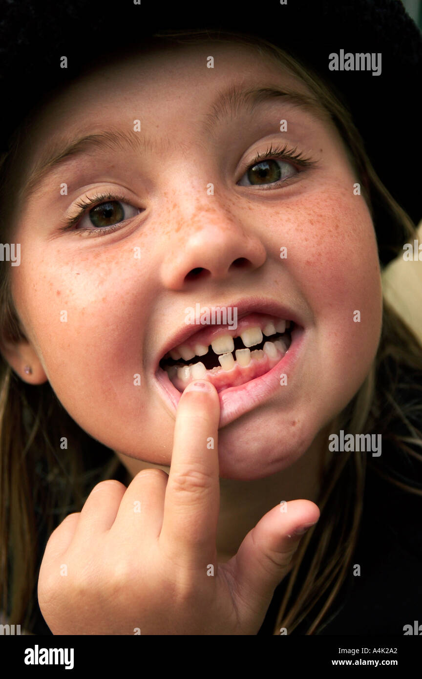 new tooth on young girl Stock Photo - Alamy