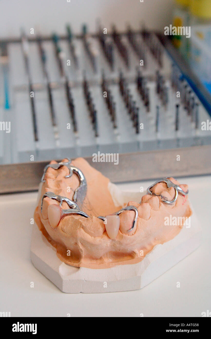 Teeth Print at the dentists office Stock Photo - Alamy
