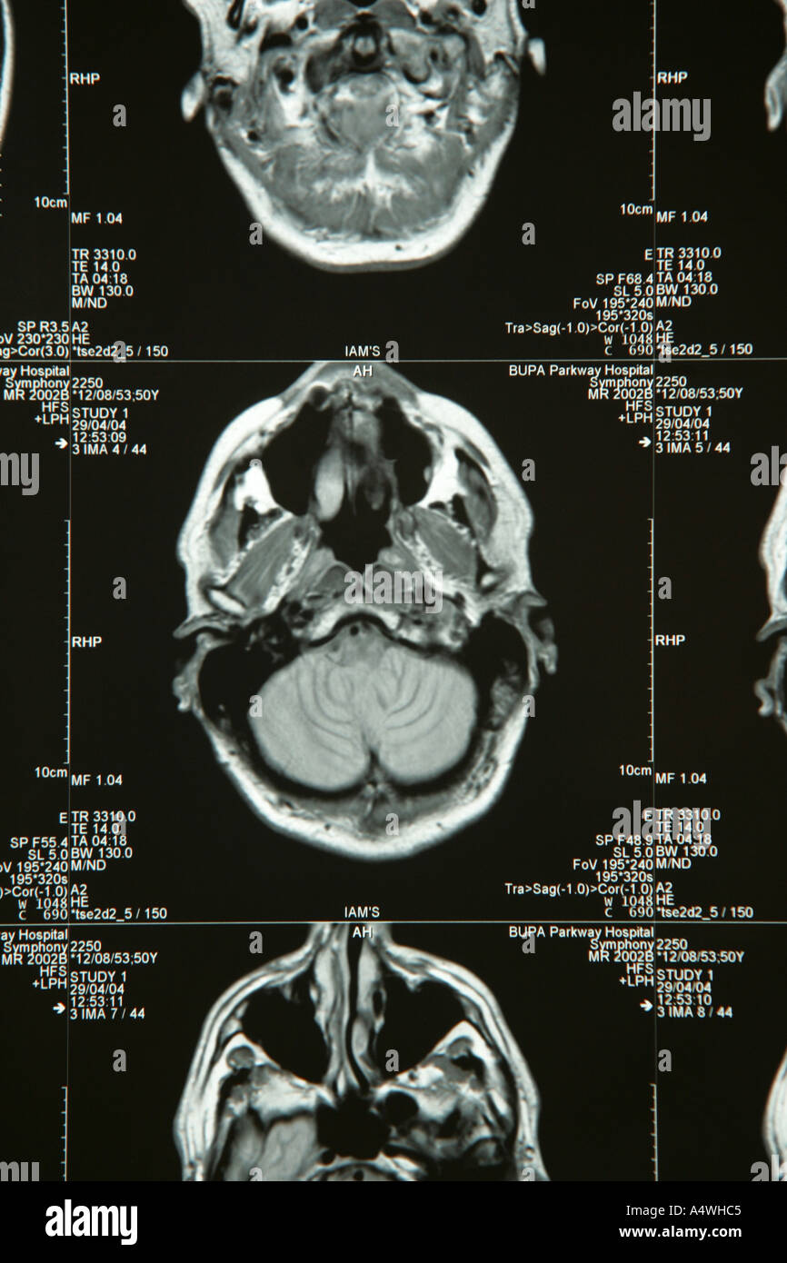 Mri scan safety hi-res stock photography and images - Alamy