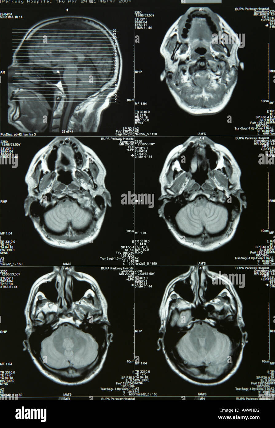 Contrast dye ct hi-res stock photography and images - Alamy