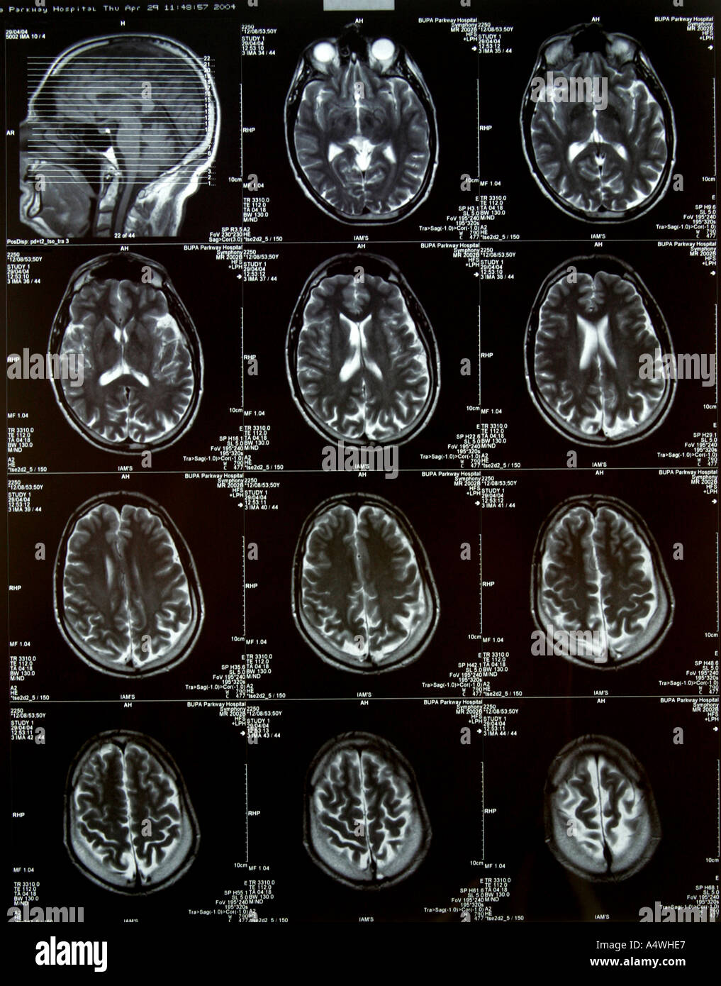 Complementary Services High Resolution Stock Photography and Images - Alamy