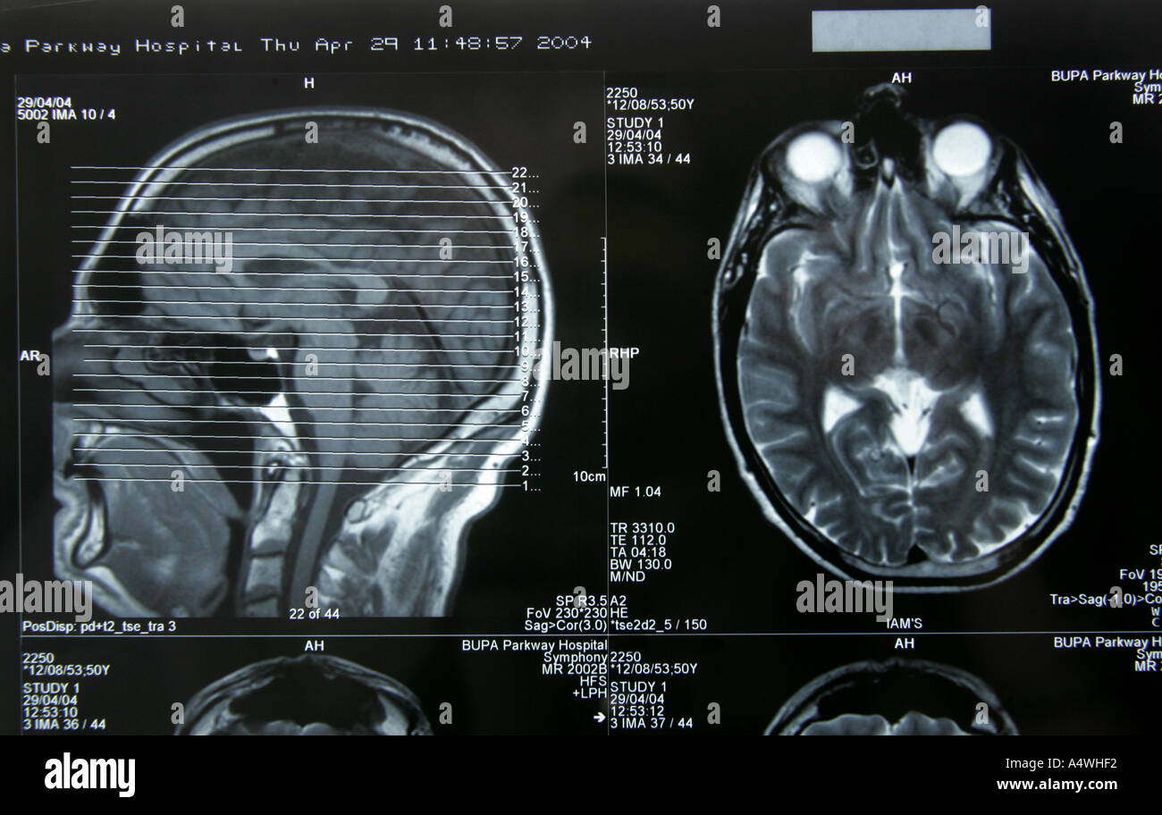 Ct scan stock hi-res stock photography and images - Alamy