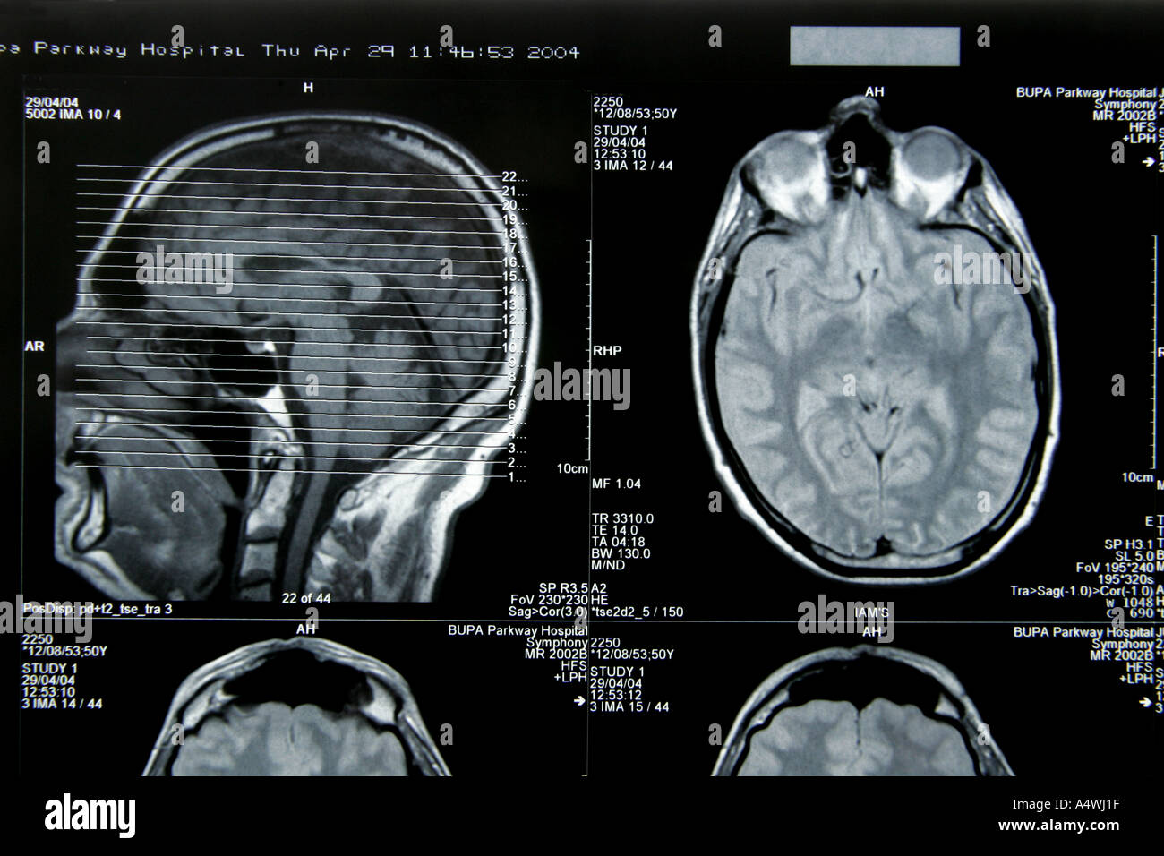 Cat scan hi-res stock photography and images - Alamy