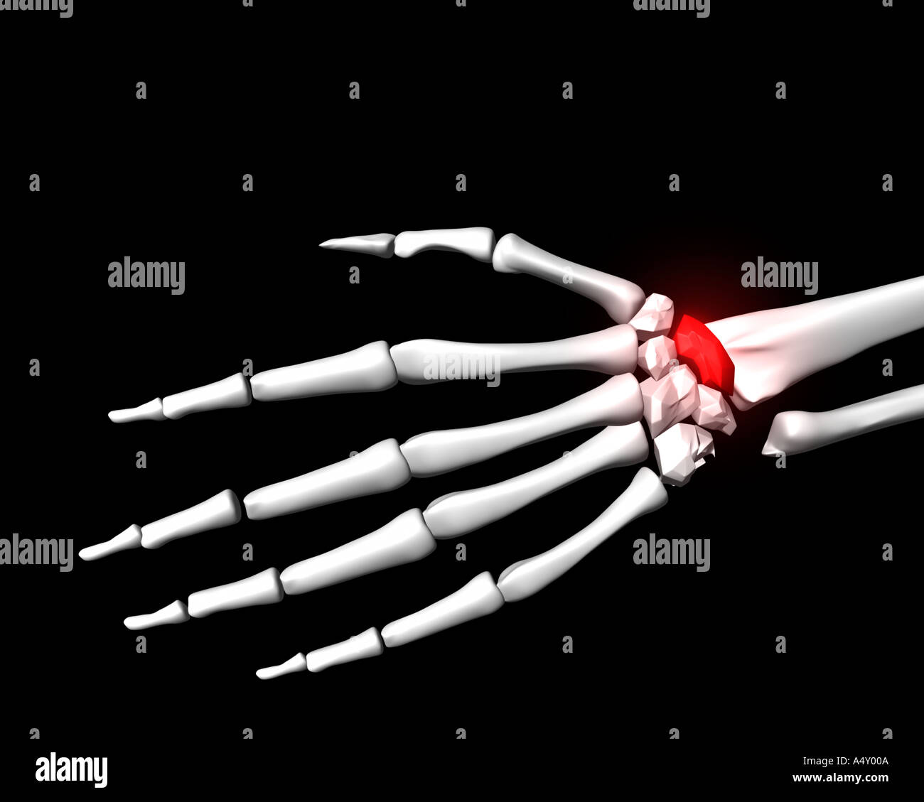 Scaphoid Stock Photos & Scaphoid Stock Images - Alamy