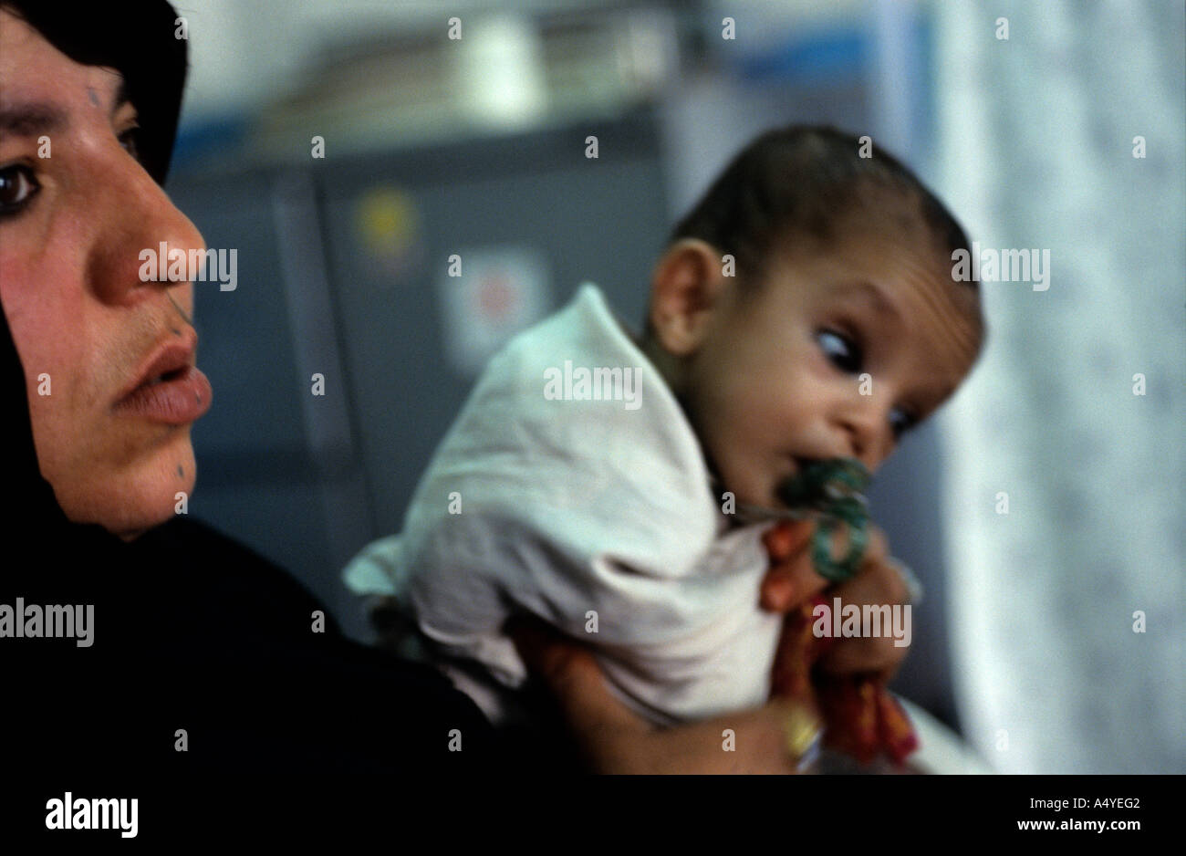 Maiwand Hospital Plastic Surgery Unit A mother and her child born with ...