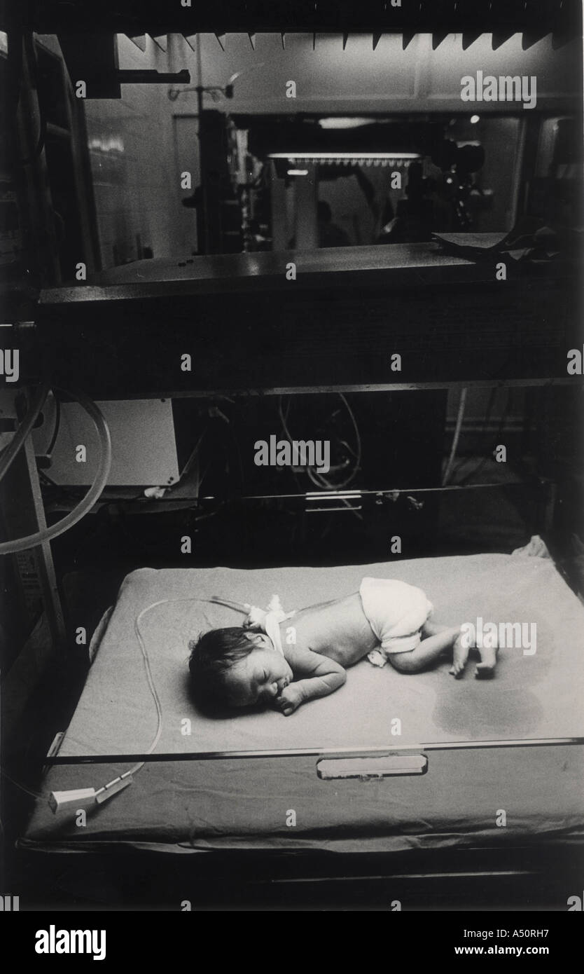 Neonatal ward hi-res stock photography and images - Alamy