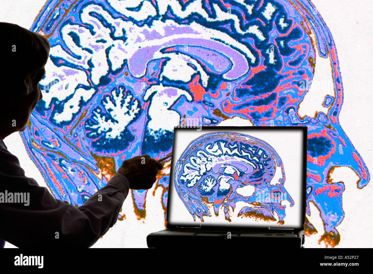 doctor pointing at projected skull image Stock Photo - Alamy doctor pointing at projected skull image Stock Photo - Alamy