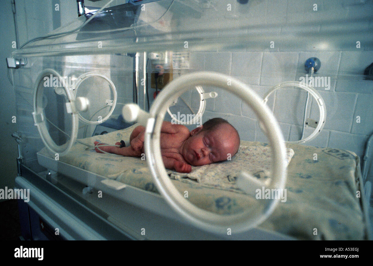 Encephalitis baby hi-res stock photography and images - Alamy