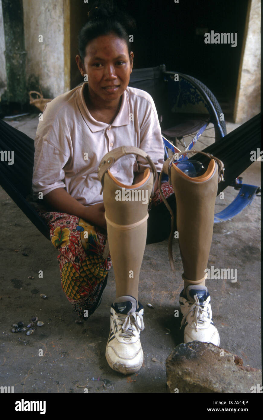 Amputee boy hi-res stock photography and images - Alamy