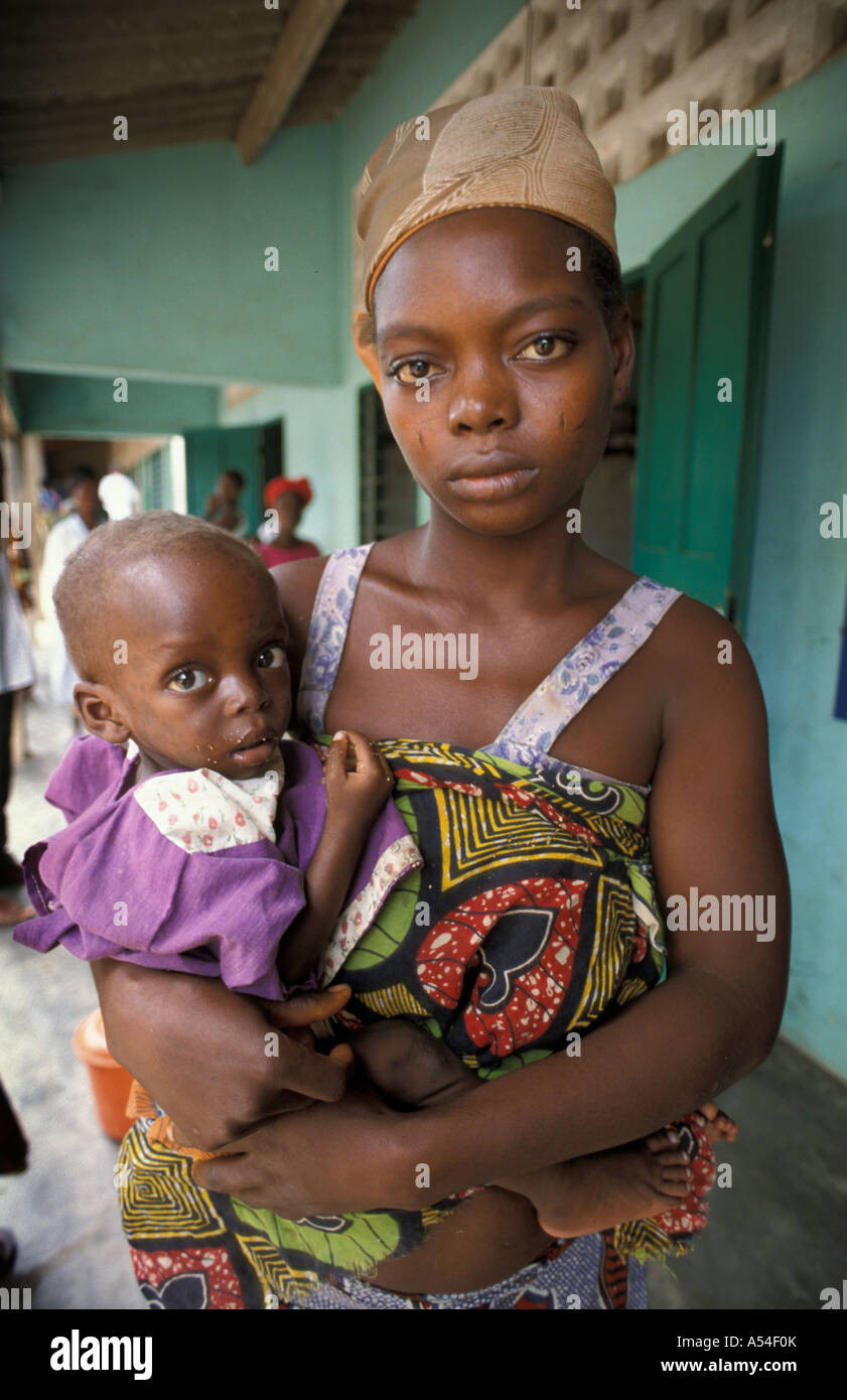 Painet hn2066 7518 benin woman malnourished child saint camille clinic ...