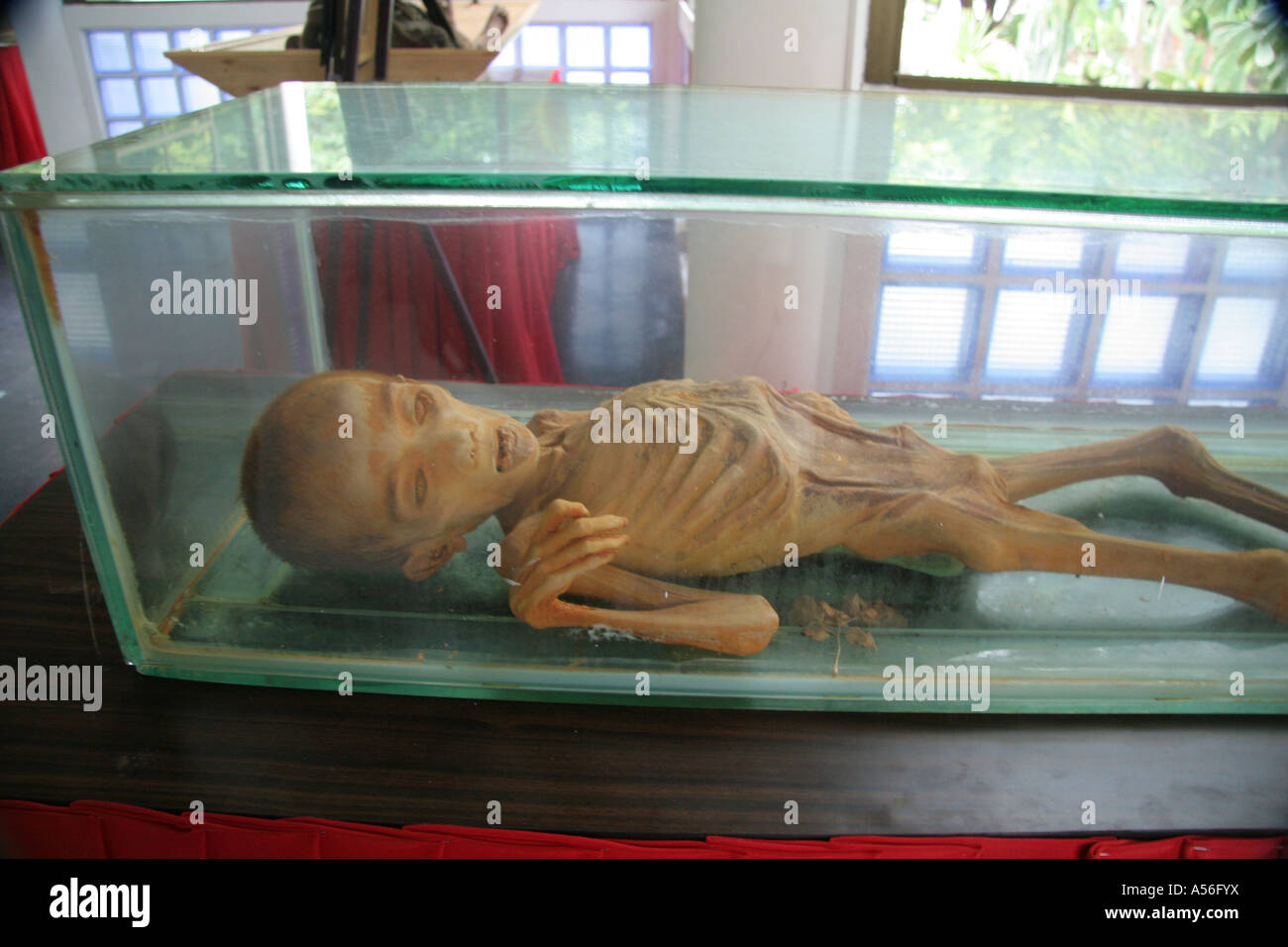 Human Cadaver Exhibit Cadaver Photography Added A New Photo. Cadaver