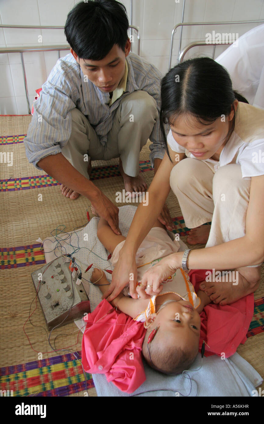 Painet iy8725 vietnam child kid receiving acupuncture treatment ...