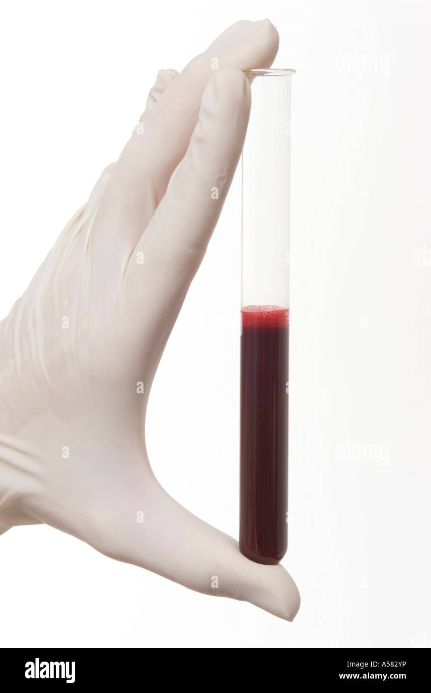 Blutbild hi-res stock photography and images - Alamy