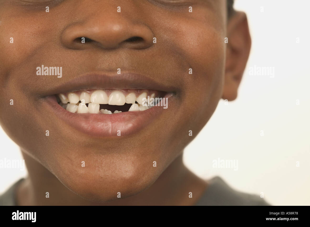 Close up of boys teeth Stock Photo - Alamy