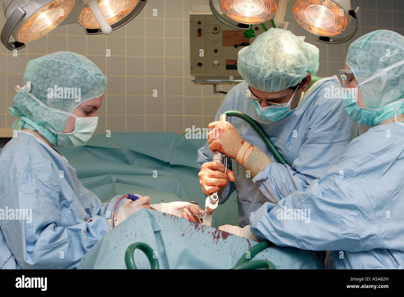 Lower leg arteries hi-res stock photography and images - Alamy