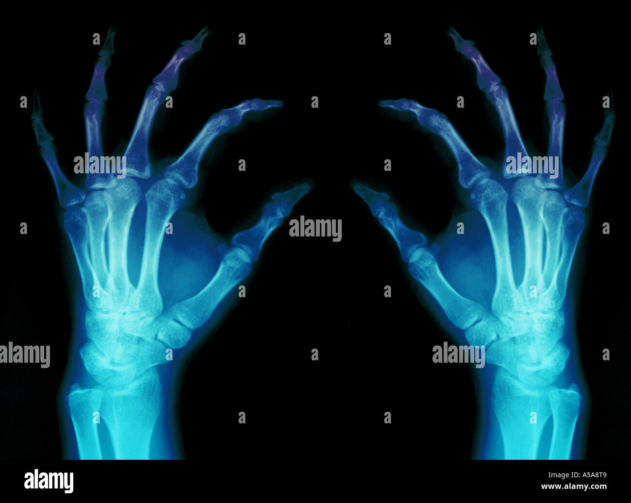 Radiological traumatology hi-res stock photography and images - Alamy