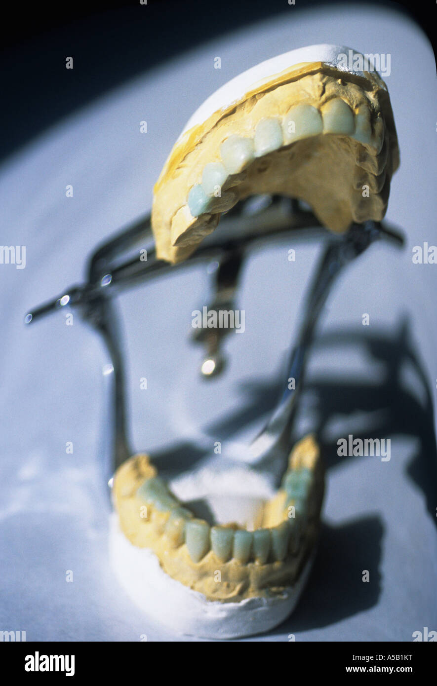Dentist's mold of teeth with mouth wide open Stock Photo - Alamy