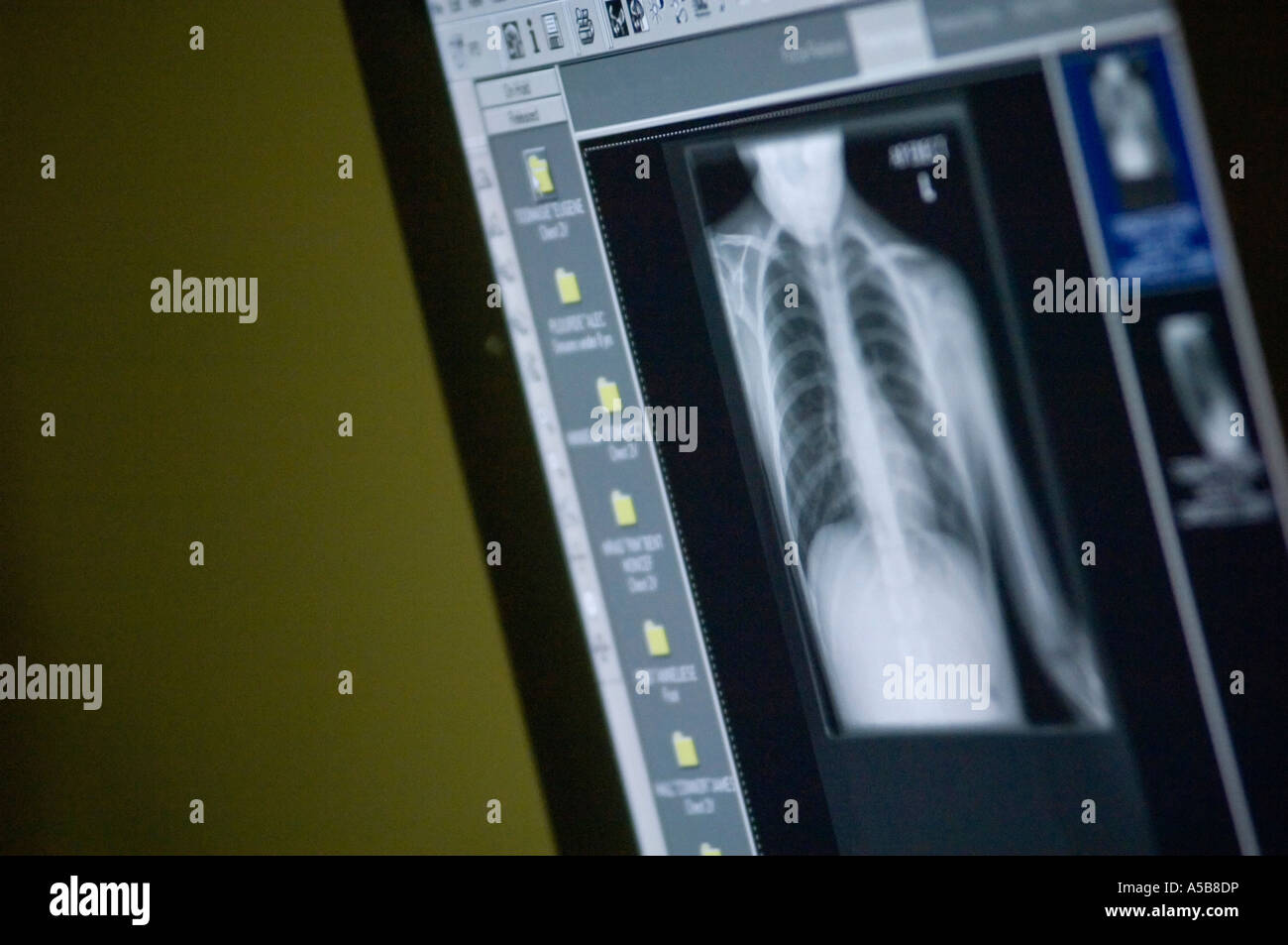 Display of diagnostic viewer Stock Photo - Alamy