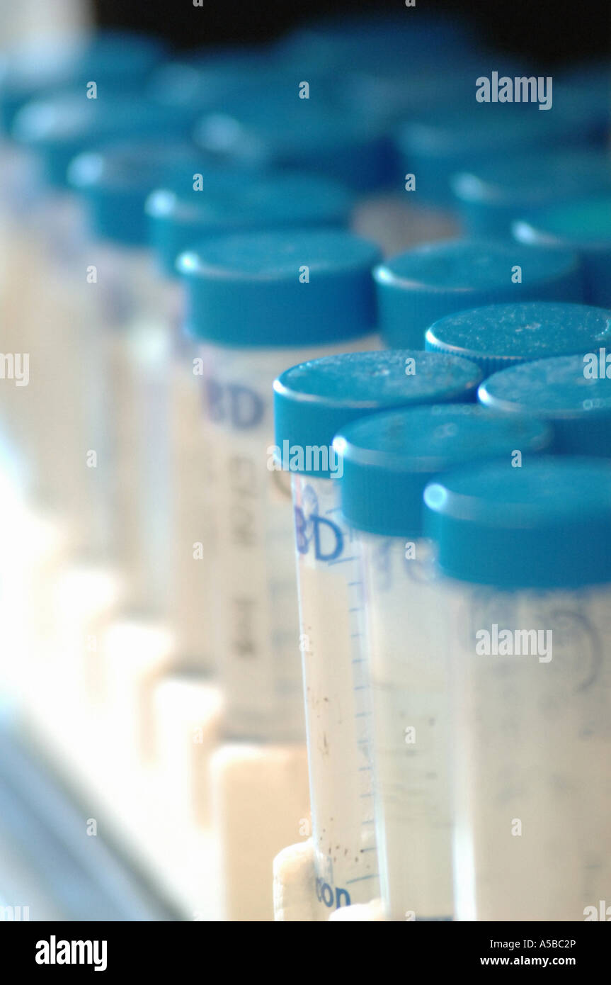 Specimen vials hi-res stock photography and images - Alamy