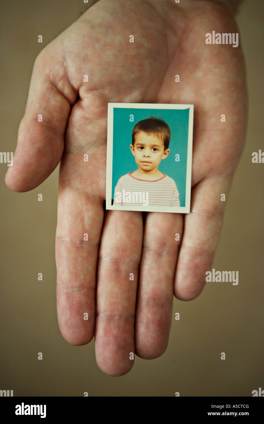 Missing finger hi-res stock photography and images - Alamy