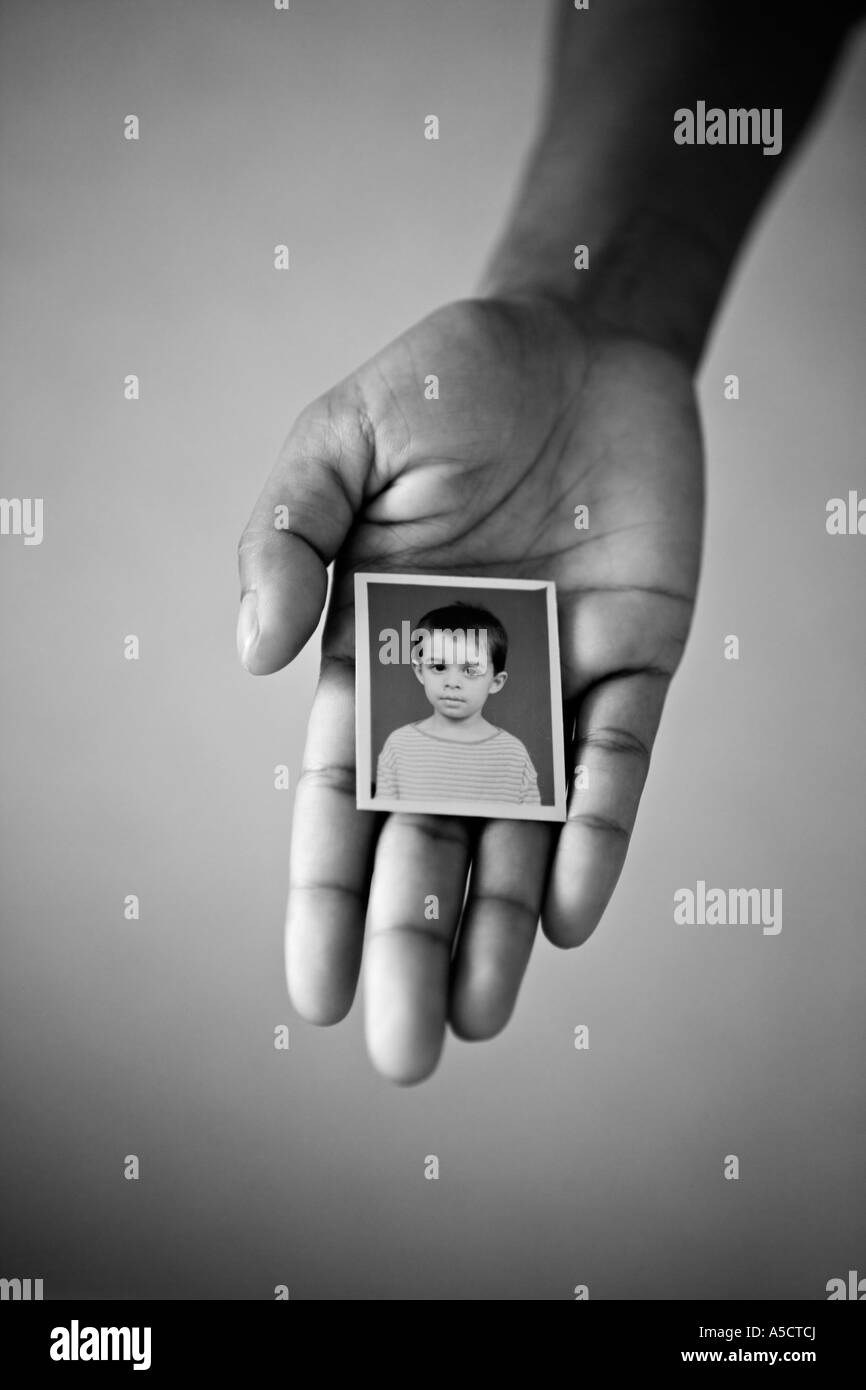Missing finger hi-res stock photography and images - Alamy