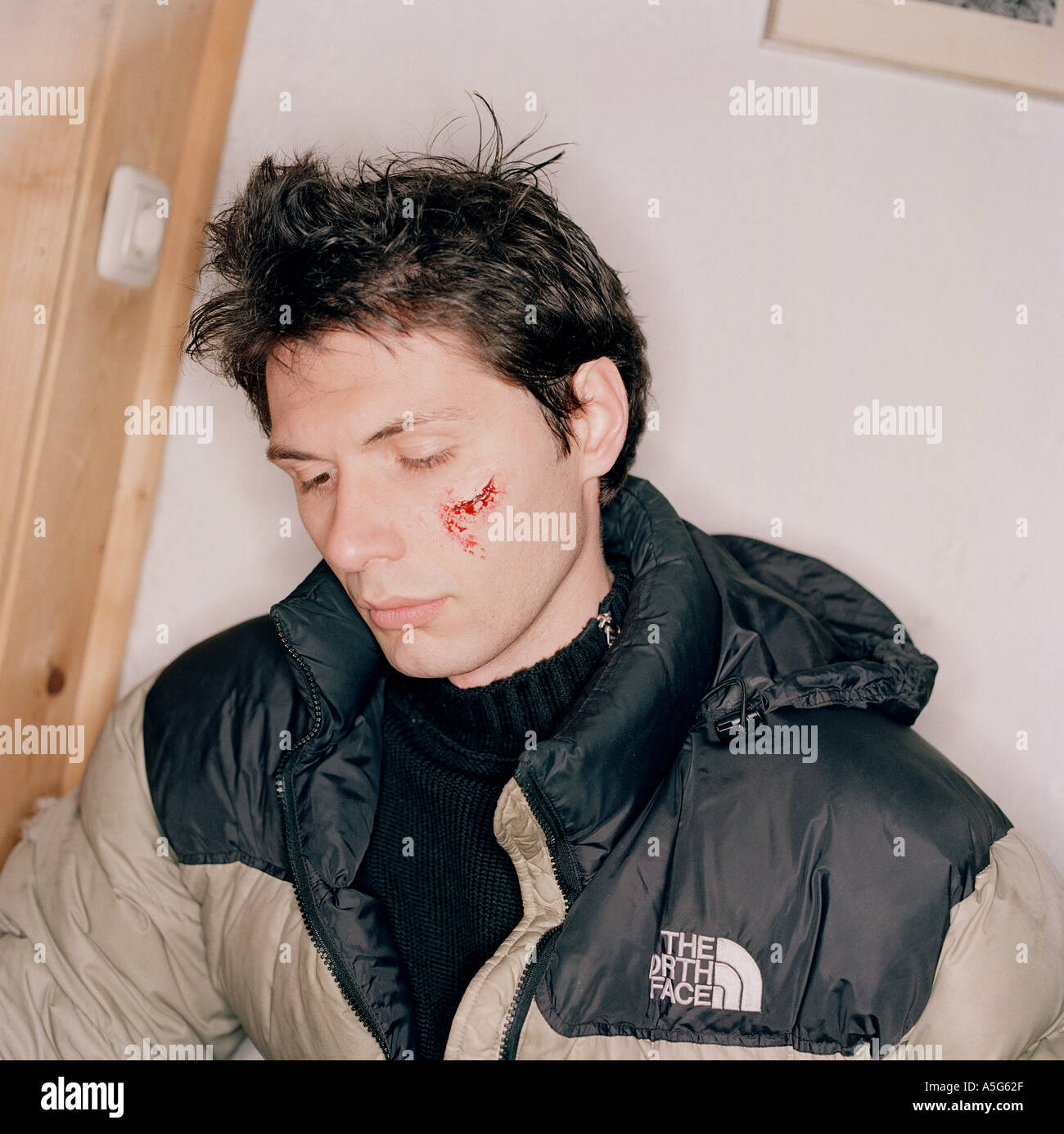 Injured boy hi-res stock photography and images - Alamy
