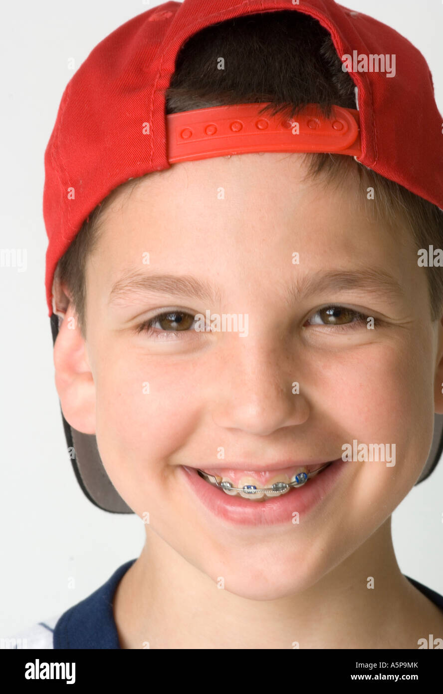 Boy with braces smiling at camera Stock Photo - Alamy