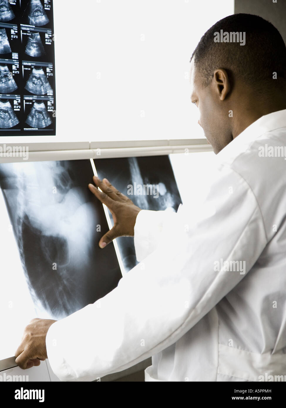 Male doctor looking at chest x rays Stock Photo - Alamy