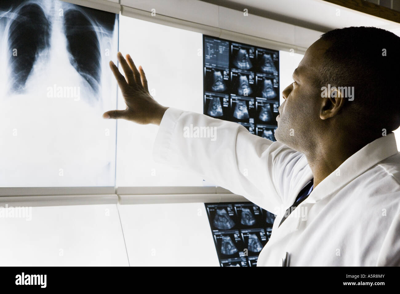Male doctor looking at chest x rays Stock Photo - Alamy