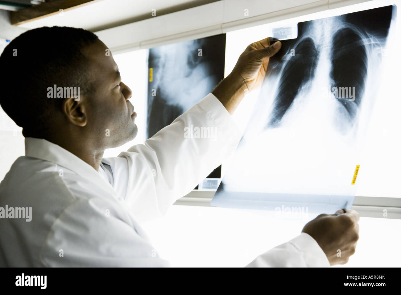 Male doctor looking at chest x rays Stock Photo - Alamy