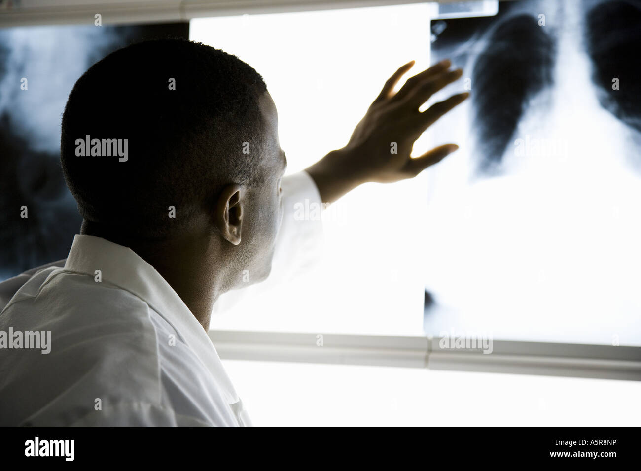 Male doctor looking at chest x rays Stock Photo - Alamy