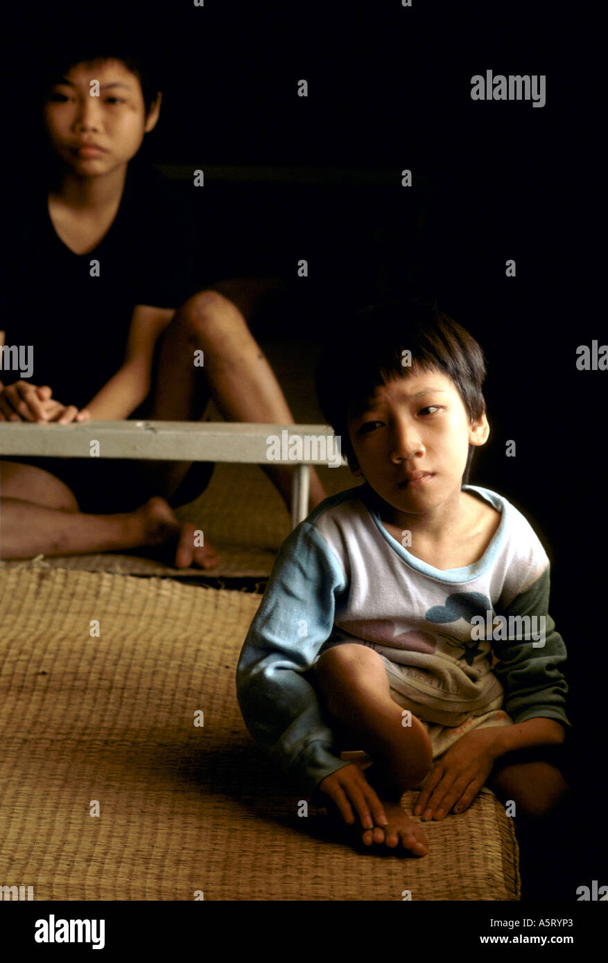 VIETNAM, A YOUNG CHILD WITH A MALFORMED LEG RESTING ON HOSPITAL BED ...