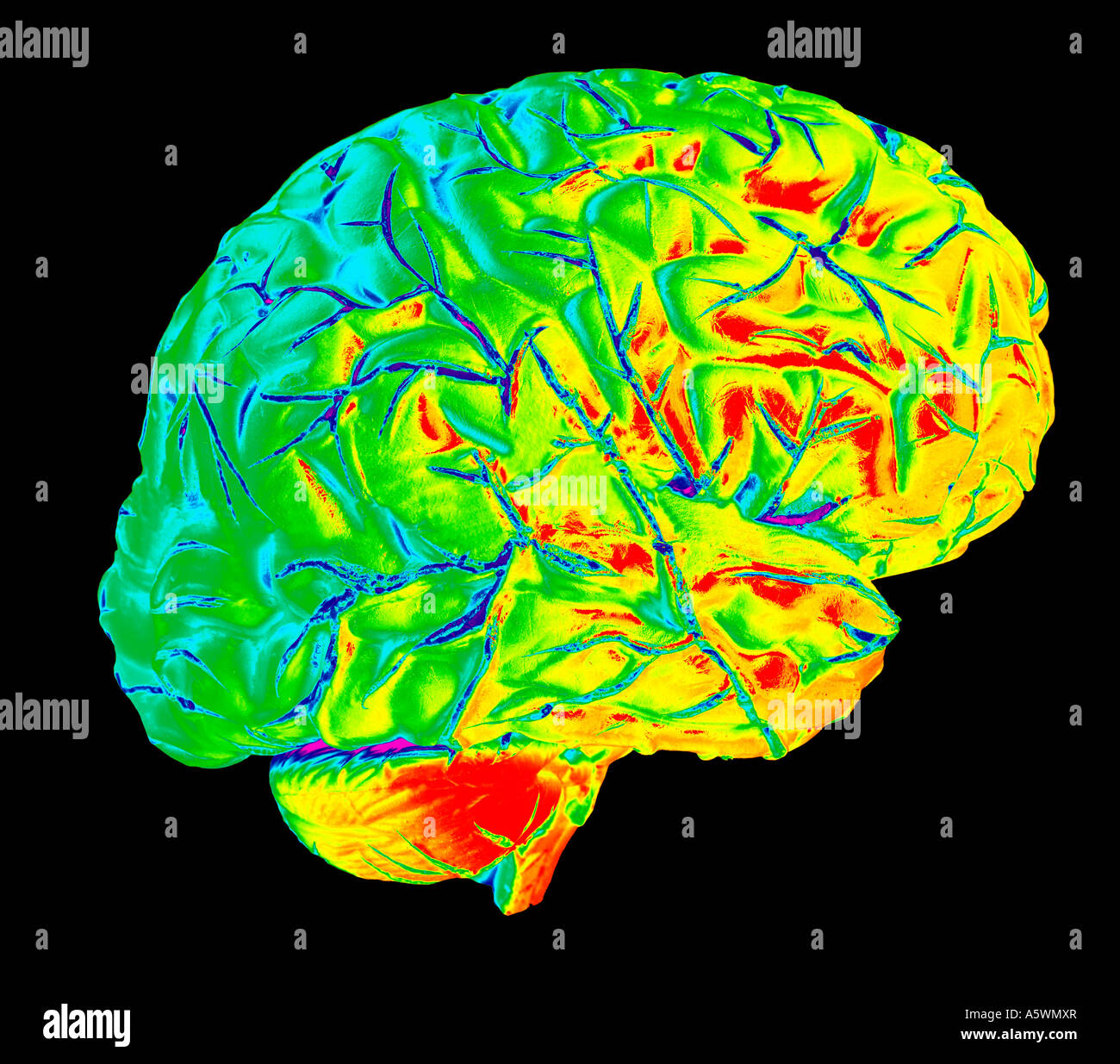 Functions Of The Brain Stock Photos & Functions Of The Brain Stock ...