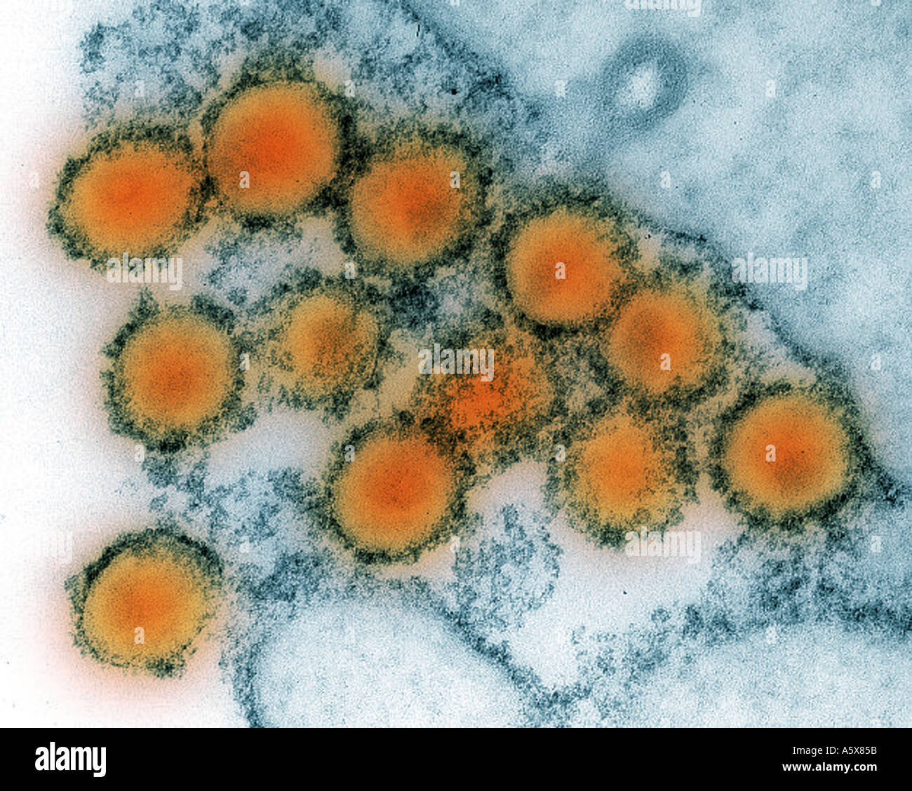 colorized electron micrograph of the AIDS virus HIV 1 Stock Photo - Alamy