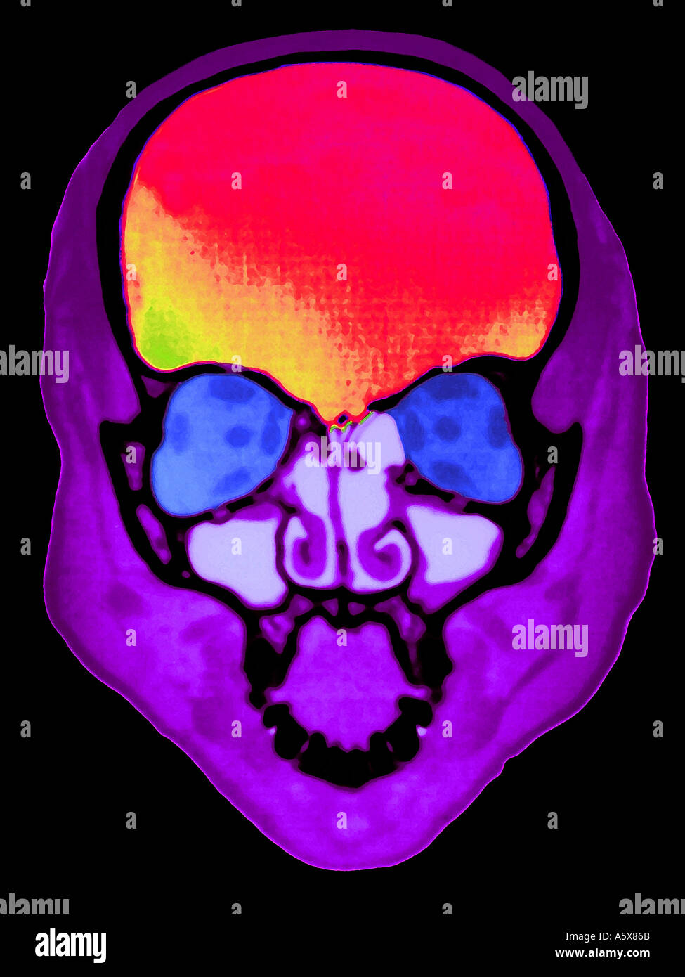 Colorized computer enhanced cat scan hi-res stock photography and ...