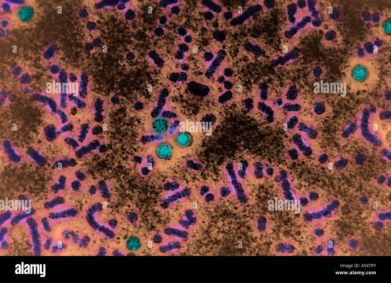Transmission electron microscope negative stained image of hepa Stock ...