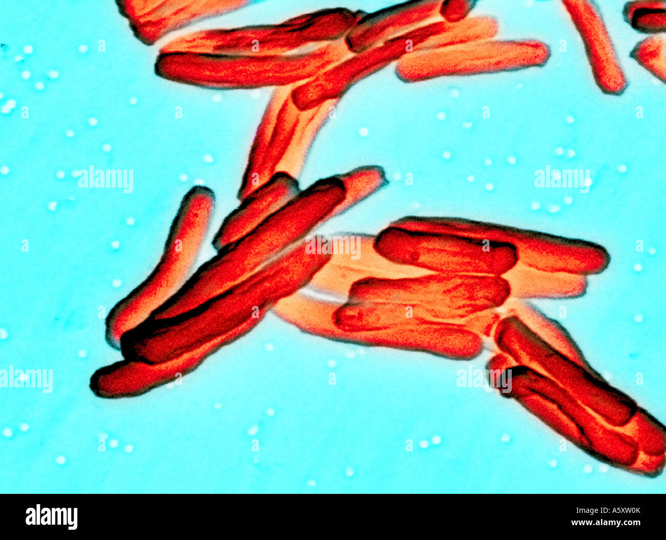 scanning electron micrograph showing the ultrastructural details seen ...