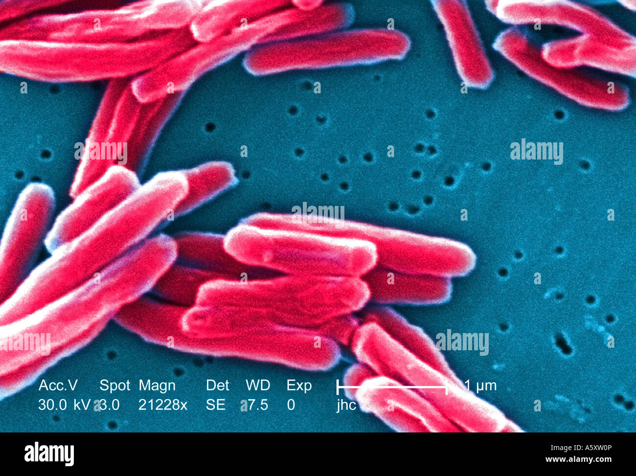 Mycobacterium tuberculosis sem hi-res stock photography and images - Alamy