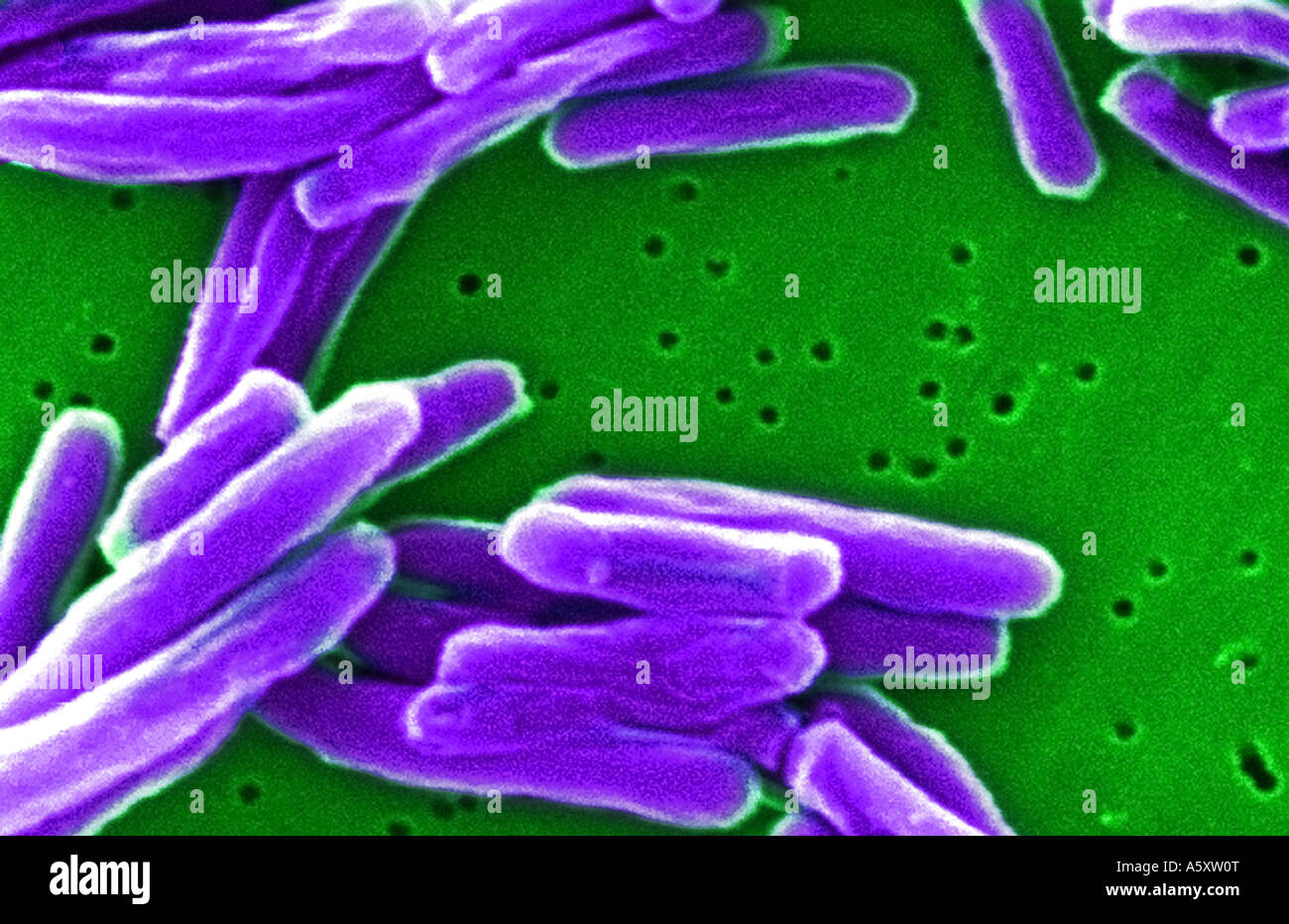 Mycobacterium tuberculosis sem hi-res stock photography and images - Alamy