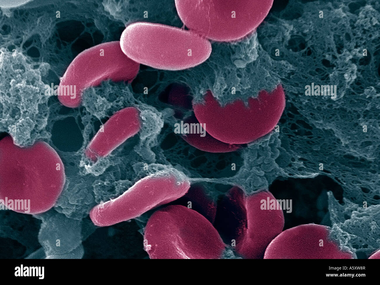Sem red blood cells human hi-res stock photography and images - Alamy
