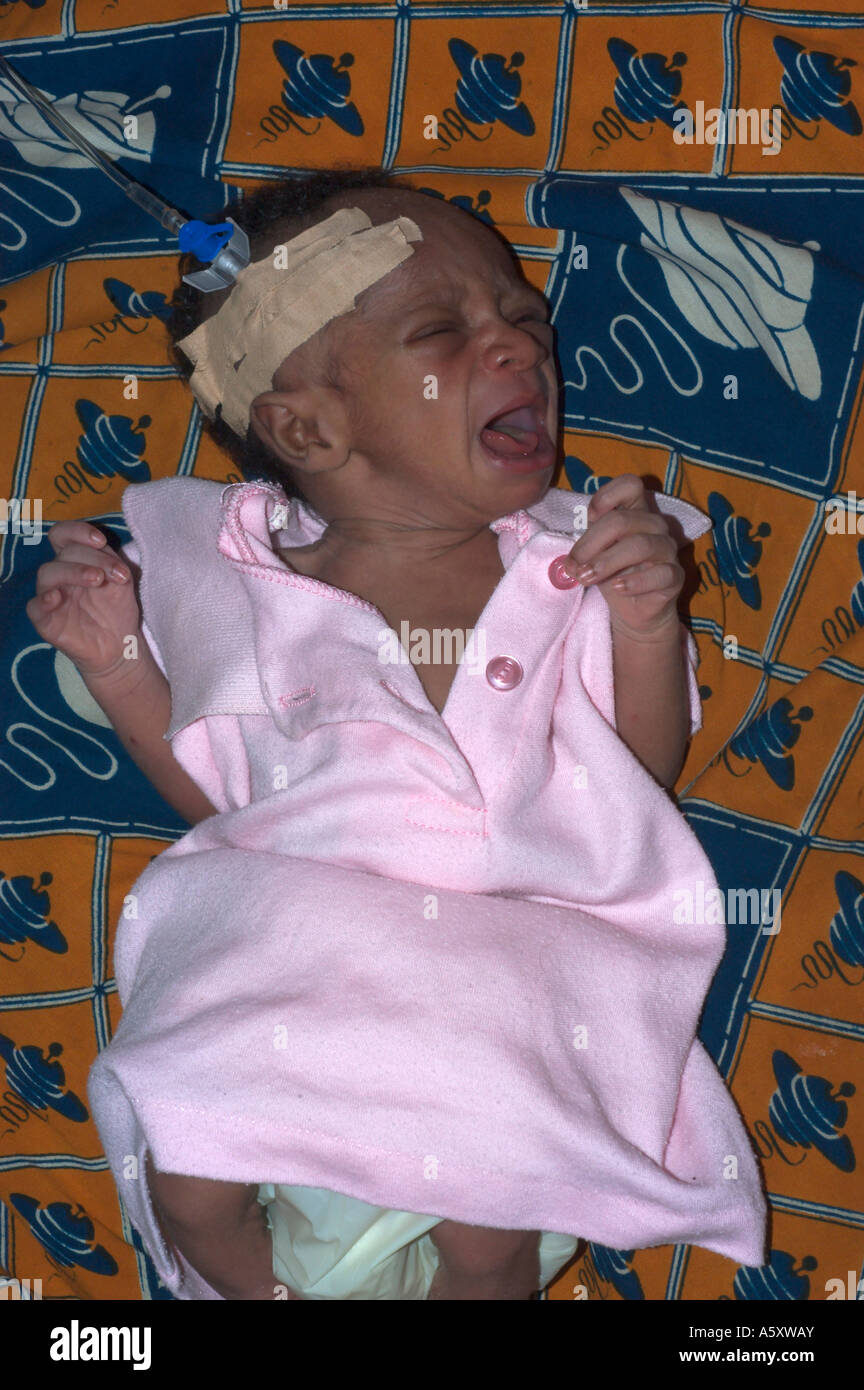 Scalp vein hi-res stock photography and images - Alamy