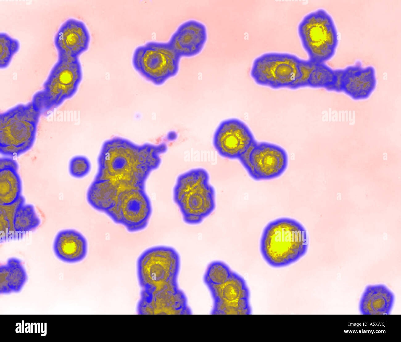 transmission electron micrograph of varicella zoster virions from ...