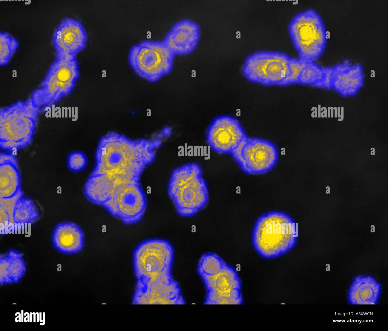 transmission electron micrograph of varicella zoster virions from ...