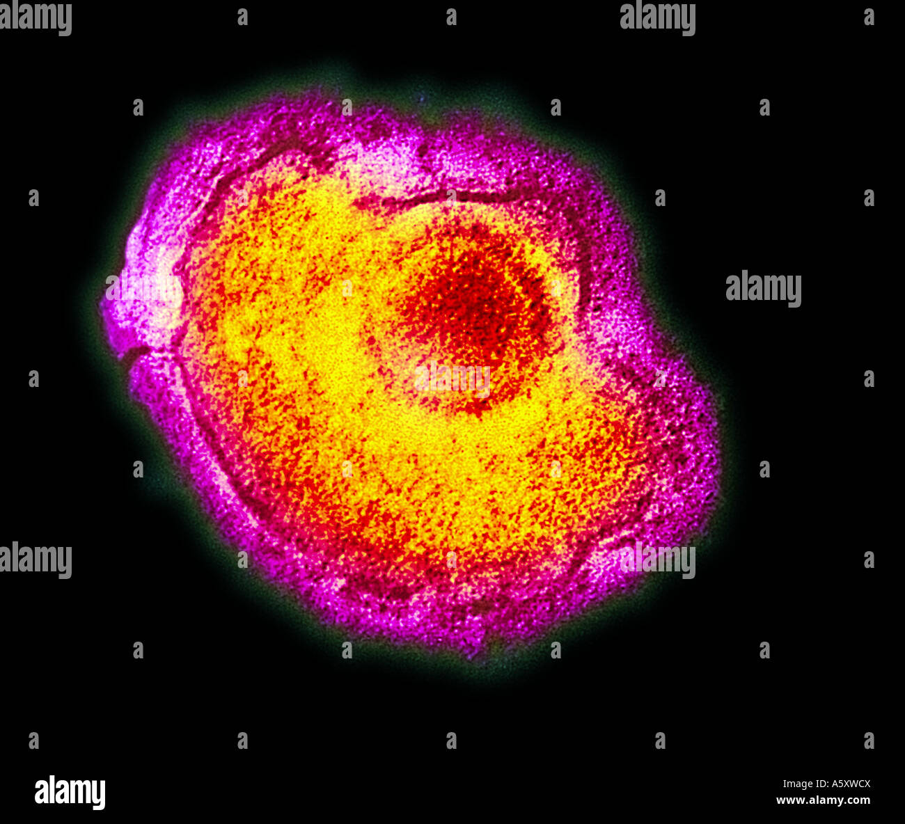 Chickenpox virus microscope hi-res stock photography and images - Alamy