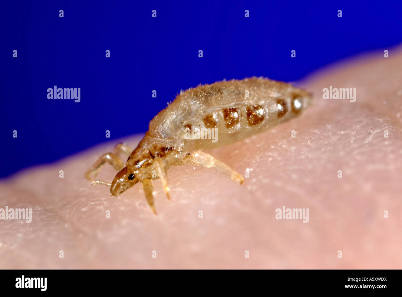 lateral view of a female body louse Pediculus humanus var corporis ...