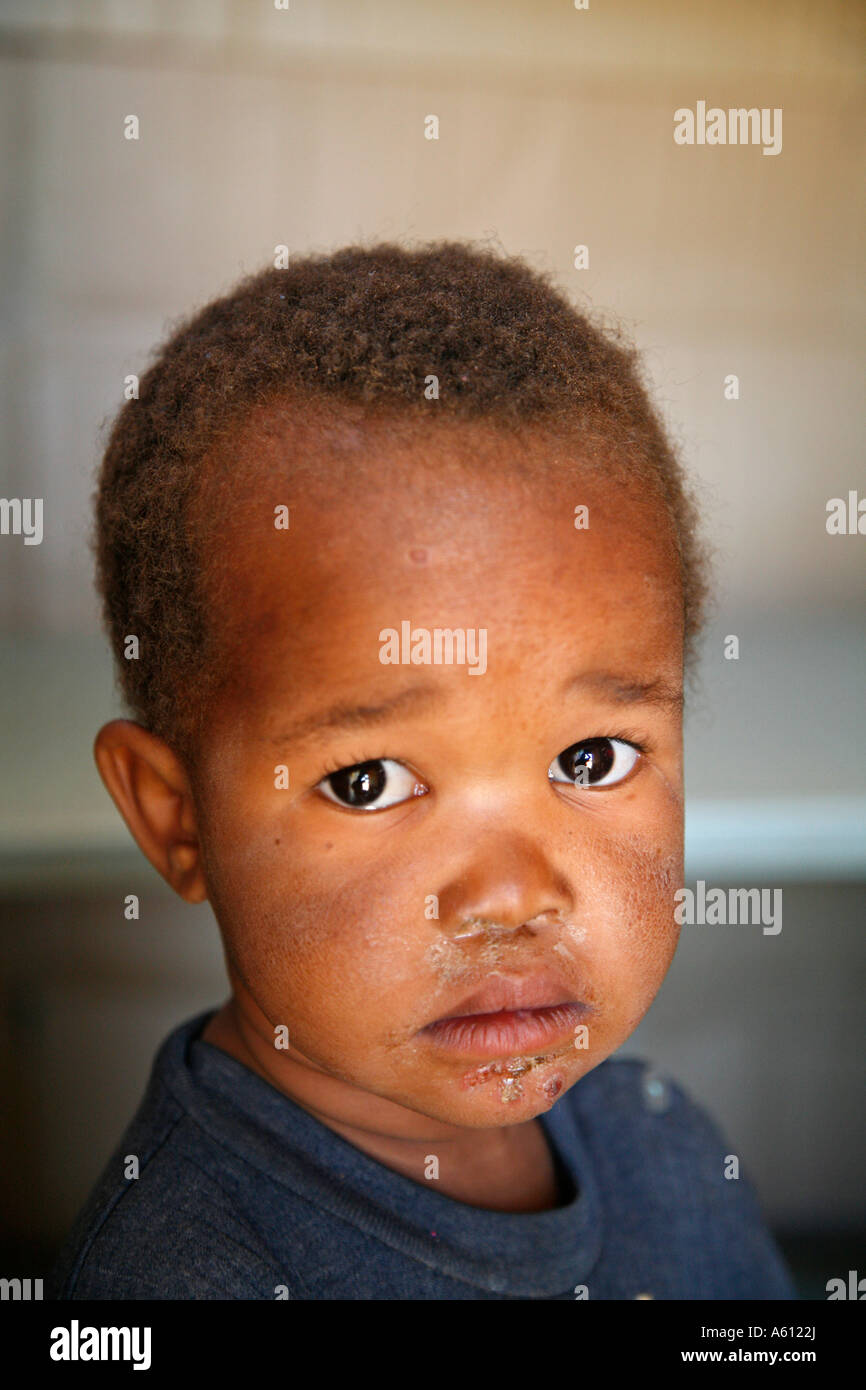 Poverty stricken child hi-res stock photography and images - Alamy